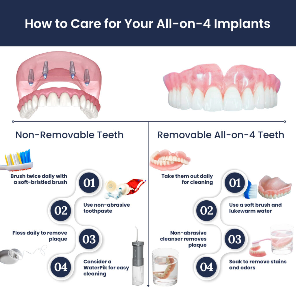 Long-Term Maintenance of All-on-4 Dental Implants | NYC Dental Implants ...